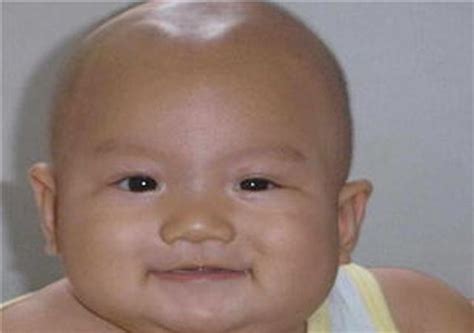 婴儿前囟门大小标准（囟门闭合的时间） 幼儿百科 魔术铺