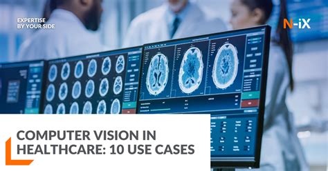 Computer Vision In Healthcare Best Use Cases N Ix