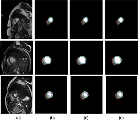 [pdf] Mamba Unet Unet Like Pure Visual Mamba For Medical Image Segmentation Semantic Scholar