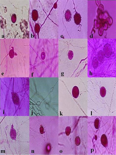 Sexual And Asexual Organs Of Pythium Species Isolated In Fars Province Download Scientific