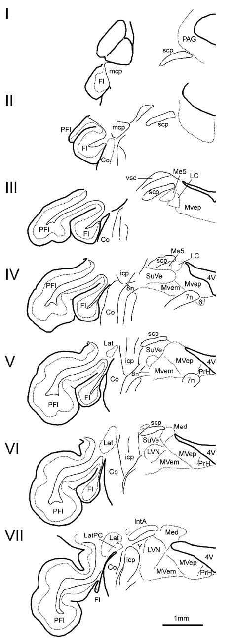 Series Of Drawings Indicating The Position And Shape Of The Flocculus