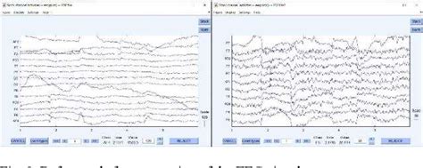 Figure 9 From An Emotion Classification Model For Driver Emotion Recognition Using