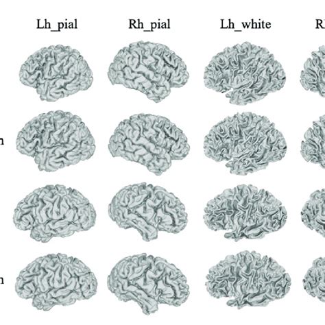 More Visualization Examples Of The Prediction Results By The Proposed