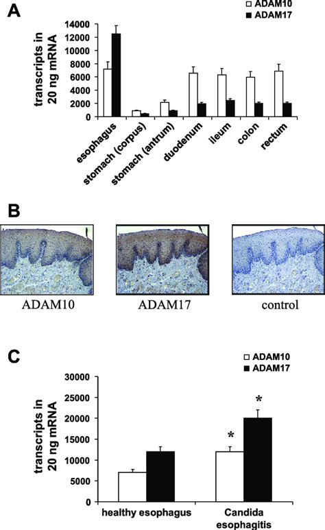Expression Of Adam10 And Adam17 In Healthy And Diseased Esophageal