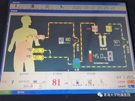 腹腔恶性肿瘤治疗神器 腹腔热灌化疗 青海大学附属医院