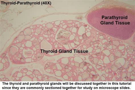 Thyroid Gland Slide Thyroid Gland Light Micrograph Stock Image
