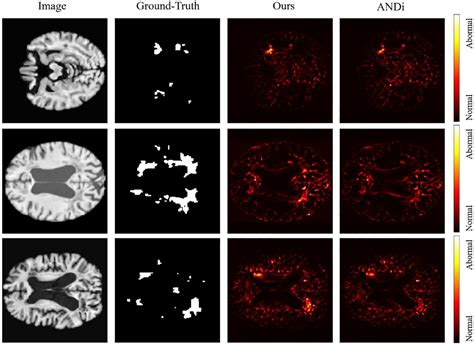 Enhancing Diffusion Models Towards Anomaly‐aware Reconstructions For