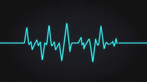 15000 Ekgline Pictures