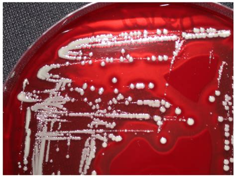 Staphylococcus Aureus As Normal Phenotype And As Small Colony Variant Download Scientific
