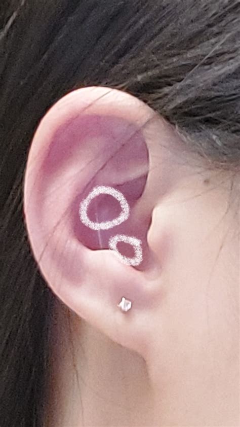 귀 여드름 지식in