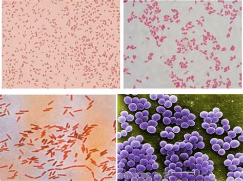 Klebsiella Staphylococcus E Coli 51 Off