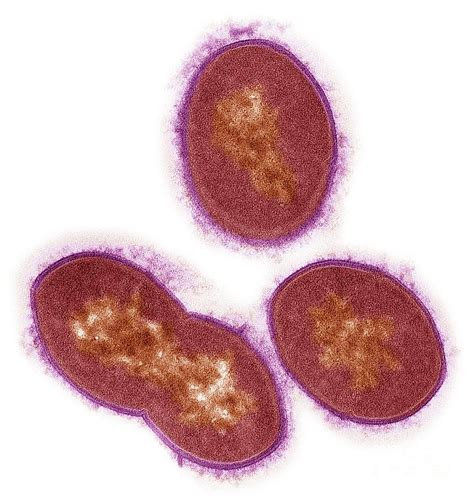 Streptococcus Bacteria Photograph By Steve Gschmeissner Science Photo