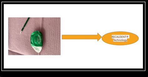 Shimaa Elsandoby On Linkedin Application Of Mi Varnish Cpp Acp