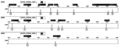 Gene Detection Kit For Hereditary Hearing Loss Eureka Patsnap
