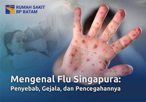 Mengenal Flu Singapura Penyebab Gejala Dan Pencegahannya Rsbp Batam