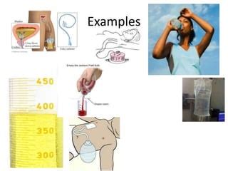 Intake Output Calculations In Nursing PPTX