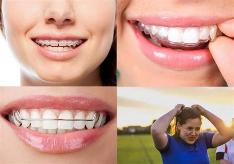 سیم کشی دندان یا ارتودنسی همه آنچه باید در مورد آن بدانید درمانگاه دندان پزشکی لبخند