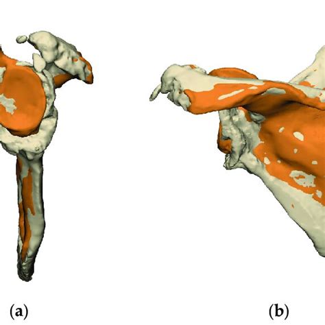 Use Of Overlaying Techniques To Assess Reconstruction Techniques Download Scientific Diagram