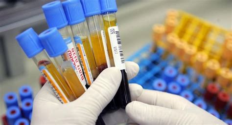 ما هو تحليل Mchc ؟ لماذا قد يطلبه الطبيب وما يجب على المريض معرفته عن هذا التحليل