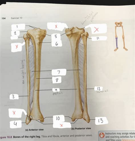 Tibia And Fibula Flashcards Quizlet