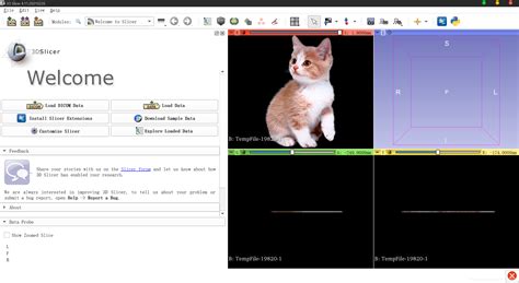 【simpleitk 学习笔记】01安装与图像读写simpleitk Readimage C Csdn博客