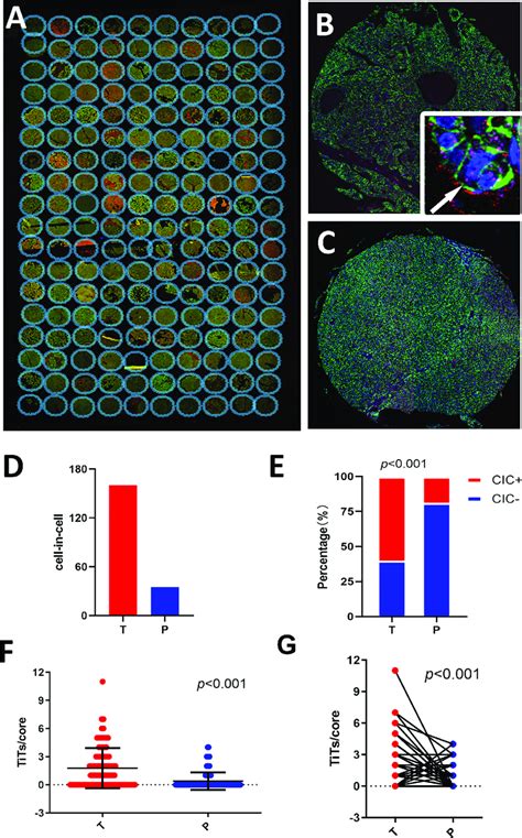 Detecting Homotypic Cics In A Tissue Microarray Tma Of Human Hcc A Download Scientific