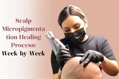 Scalp Micropigmentation Healing Process Week By Week