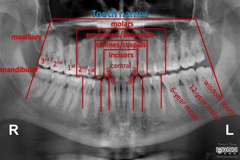 Tooth Notation Permanent Adult Radiology Case Radiology Dentistry