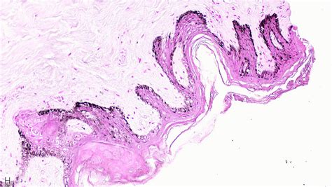 Ihisto Fontana Masson Stain Melanin Stain