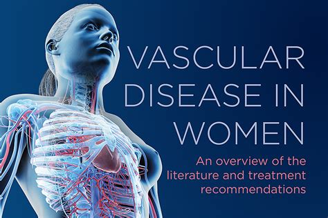 Vascular Disease In Women Presents Differently Than It Does In Men