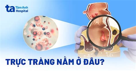 Tr C Tr Ng L G V Tr Gi I Ph U C U T O V Ch C N Ng Trong C Th