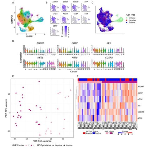 Single Cell And Bulk Rna Seq Of Patient Derived Mcc Tumor Biopsies