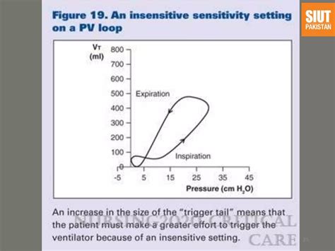 Ventilator Waveforms Ppt