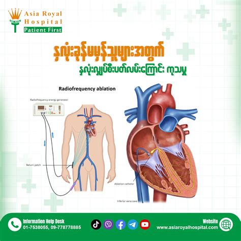 နှလုံးခုန်မမှန်သူများအတွက် Asia Royal Hospital