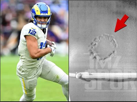 Puka Nacua Speaks Up On The Consequences Of The Bite Lawsuit