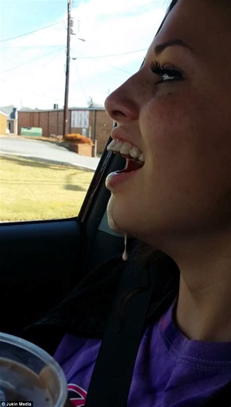 Woman Tries A Milkshake After Surgery On Her Wisdom Teeth And It Goes