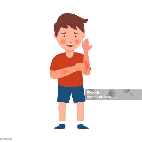 팔을 긁는 소년 아이들 평평한 디자인에서 강한 알레르기 피부 가려운 증상으로 고통받는 아이들 붉은 발진 피부 자극 아이에 대한