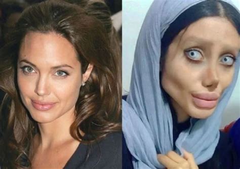 What S Wrong With Plastic Surgery At Emma Sparks Blog