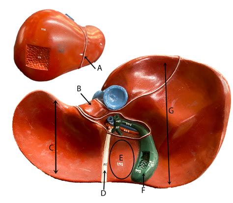 Liver And Spleen Diagram Quizlet