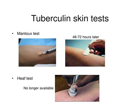 PPT TB The Coventry Perspective PowerPoint Presentation ID