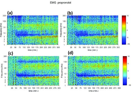 Spectral Analysis Of Electrophysiology Recording Of Rat Brain In
