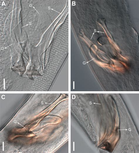 Gubernaculum In Different Positions From Different Specimens Of