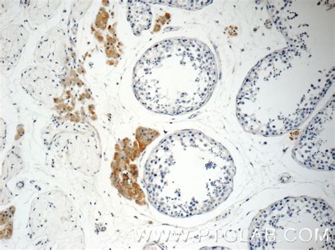 Stat1 Antibody 10144 2 Ap Proteintech