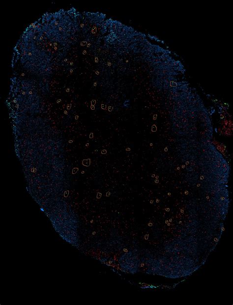 How To Create Segmentationsurfacecell Detection If The Cell Density