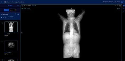 Measuring Tools Are Not Showing In The Viewer V 3 Issue 3373 OHIF