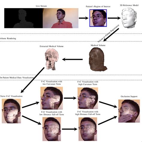 Overview Of The Proposed Approach Top Layer From An RGB D Live Download Scientific Diagram