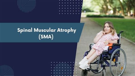Spinal Muscular Atrophy Sma