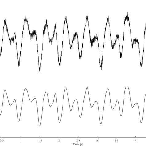 The Four Signals And Their Differential Signals Ecg Blue Ppg Red Download Scientific