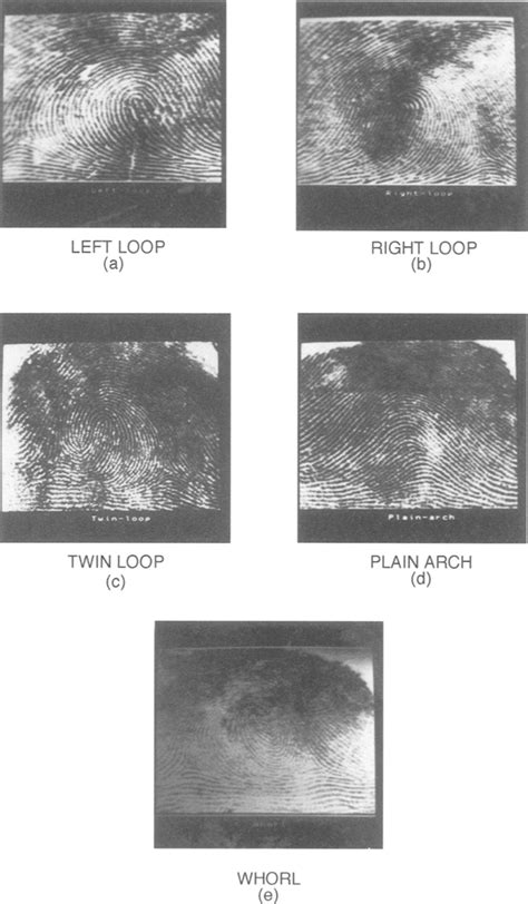 the five varieties of fingerprint patterns used left loop right loop