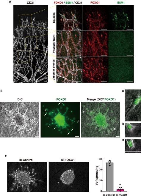 Foxo1 Stimulates Tip Cell Enriched Gene Expression In Endothelial Cells Iscience